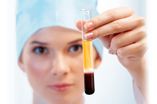PRP cheveux Tunisie : injection plasma riche en plaquettes, soin capillaire